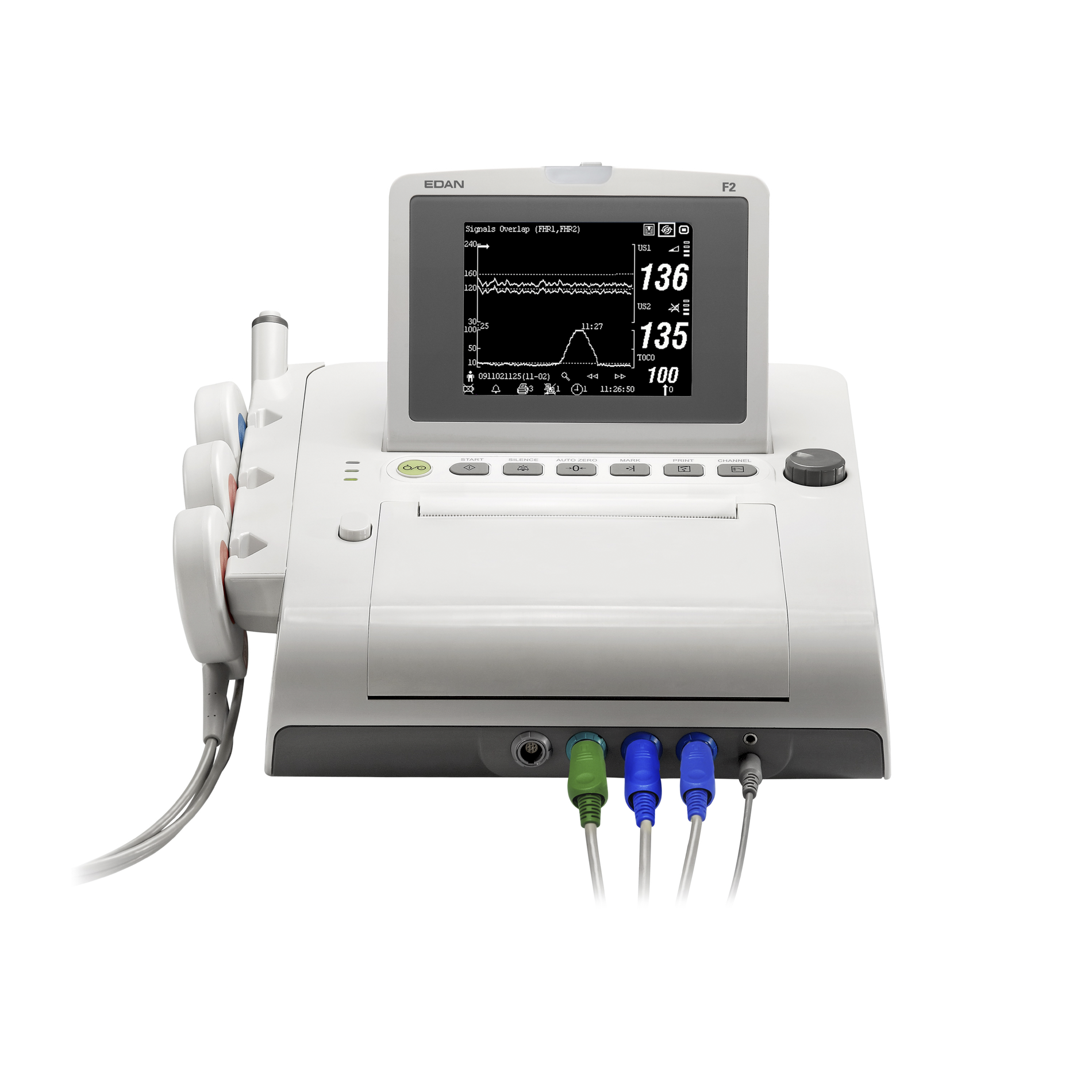 Fetální monitor F2 pro monitorování dítěte - POLYMED medical | Váš ...